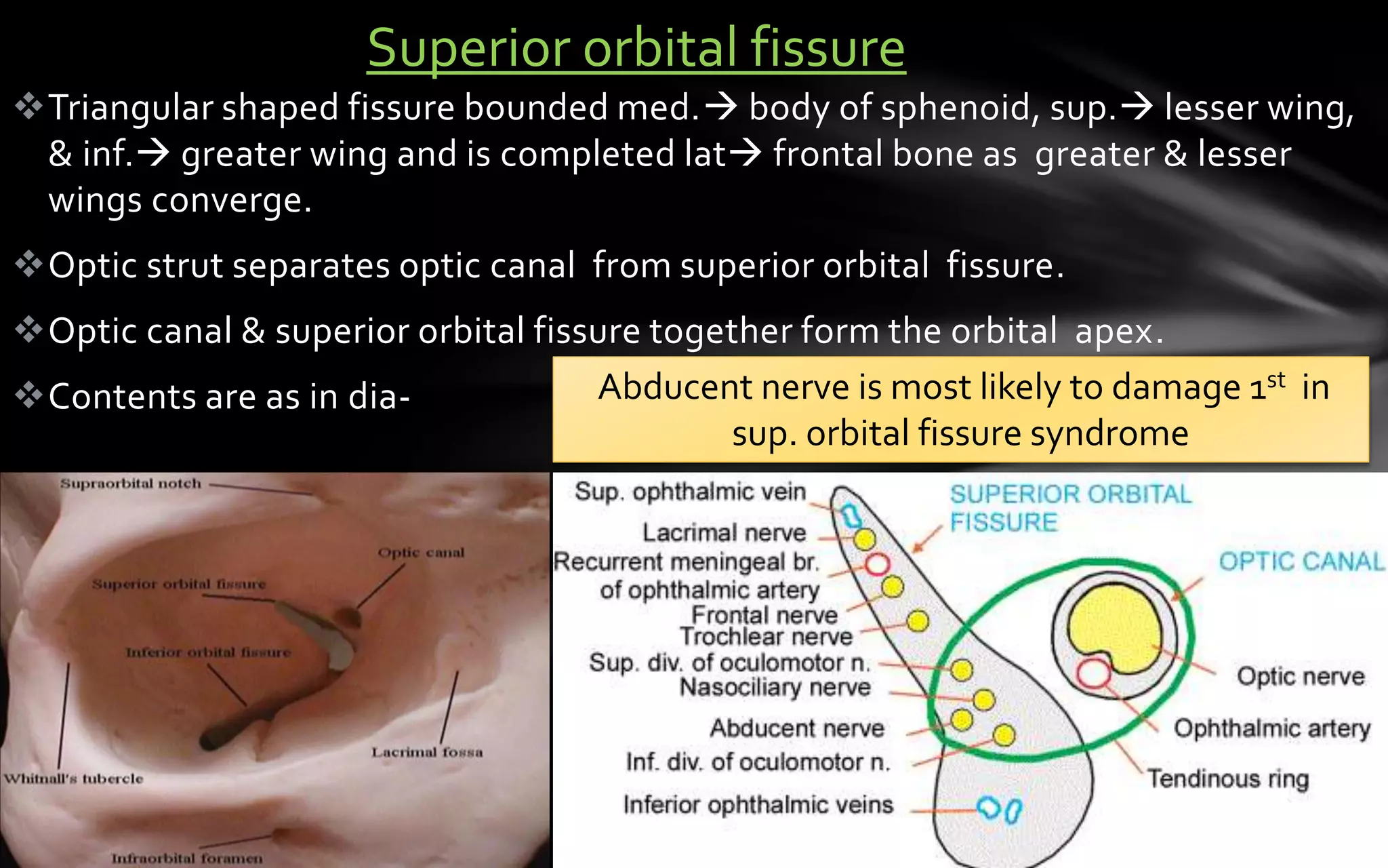 Skull base anatomy by Dr. Aditya Tiwari | PPTX