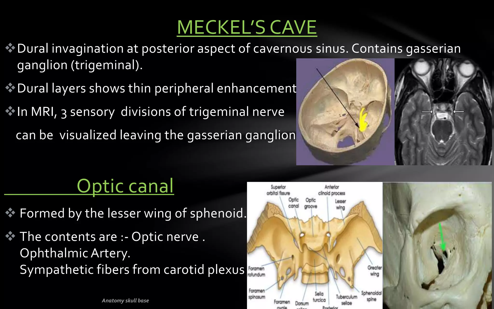 Skull base anatomy by Dr. Aditya Tiwari | PPTX
