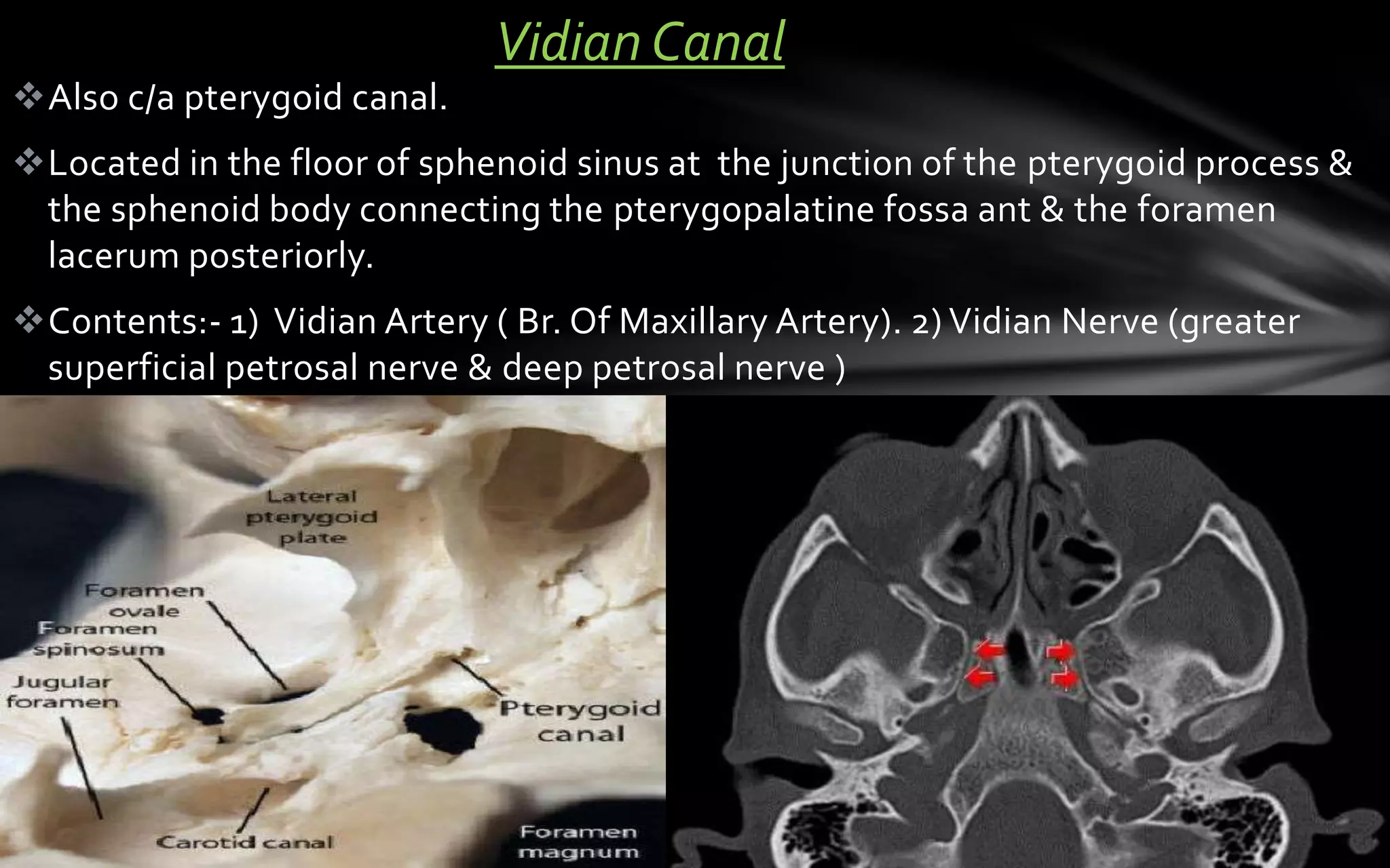 Skull base anatomy by Dr. Aditya Tiwari | PPTX