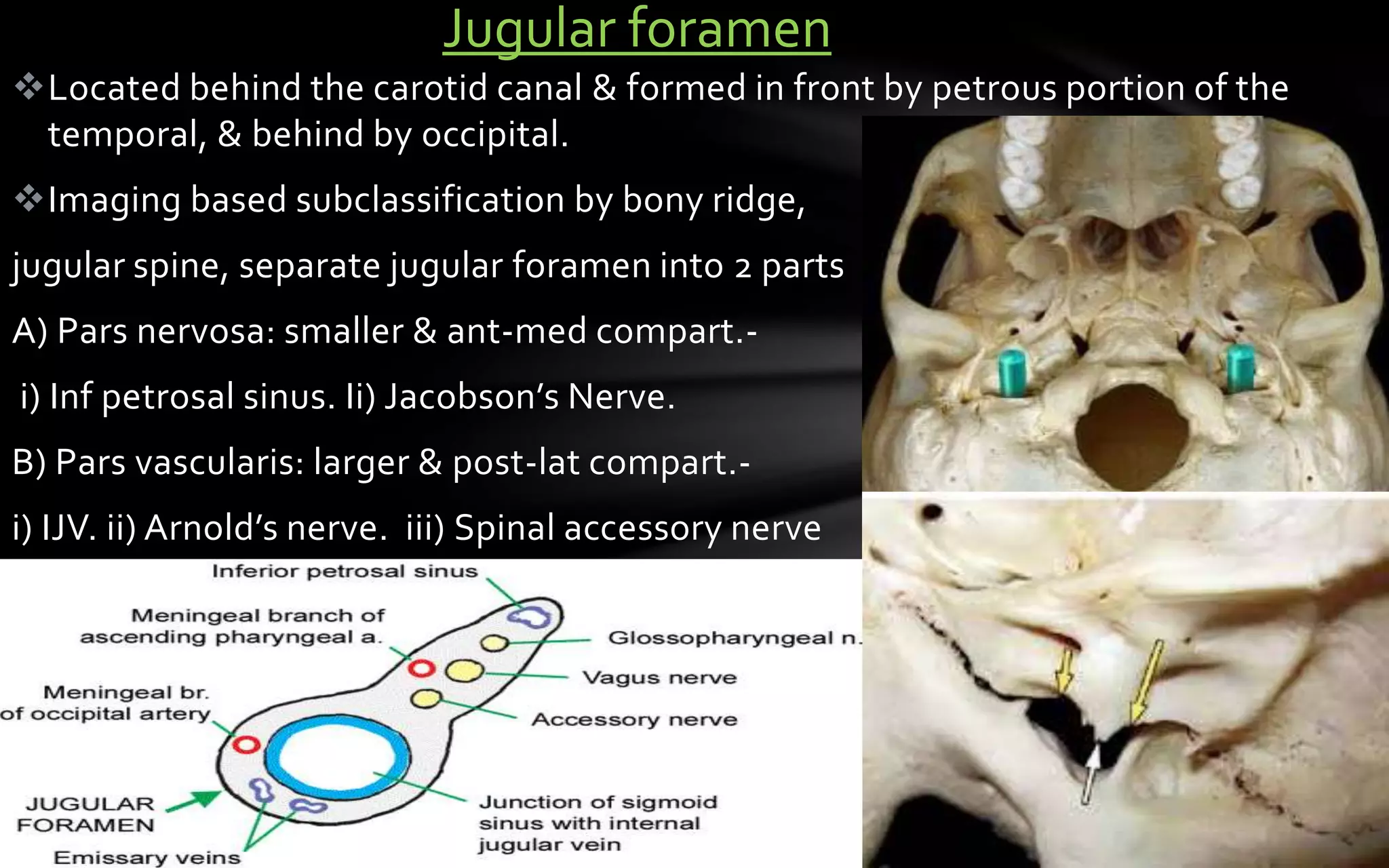 Skull base anatomy by Dr. Aditya Tiwari | PPTX