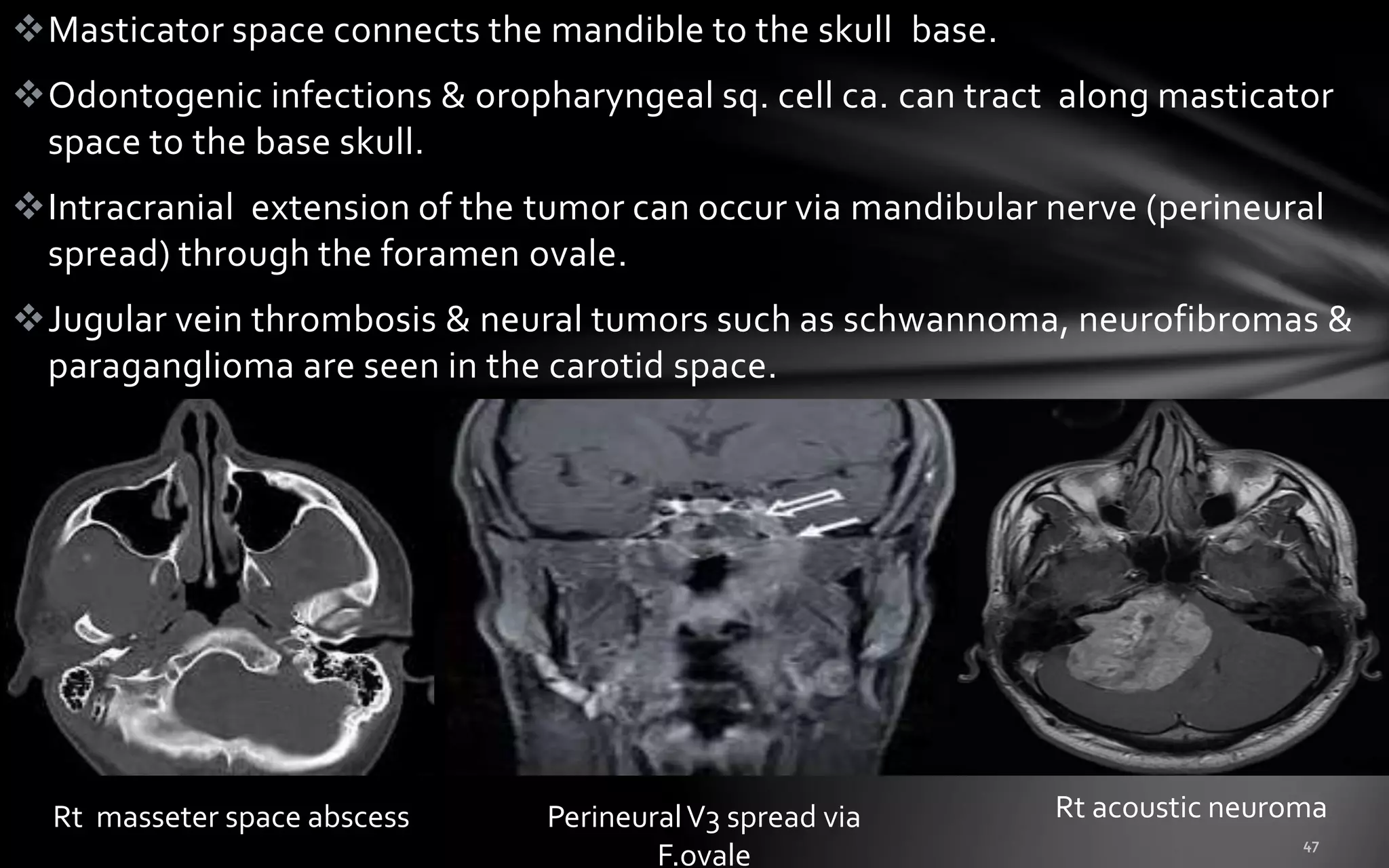 Skull base anatomy by Dr. Aditya Tiwari | PPTX