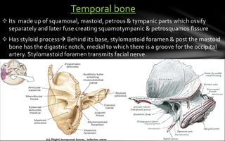 Squamotympanic Fissure