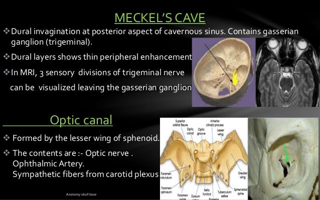 Skull base anatomy by Dr. Aditya Tiwari