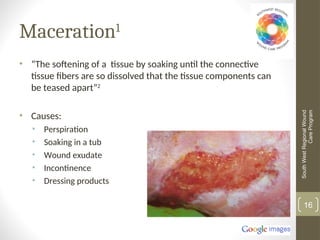 Assessment of Adjacent Tissues Assessment of Adjacent Tissues | PPT