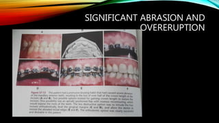 Adjunctive role of orthodontic therapy | PPTX
