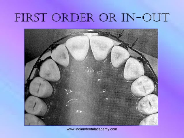 Adjuncts in straight wire technique /certified fixed orthodontic courses by Indian dental ...