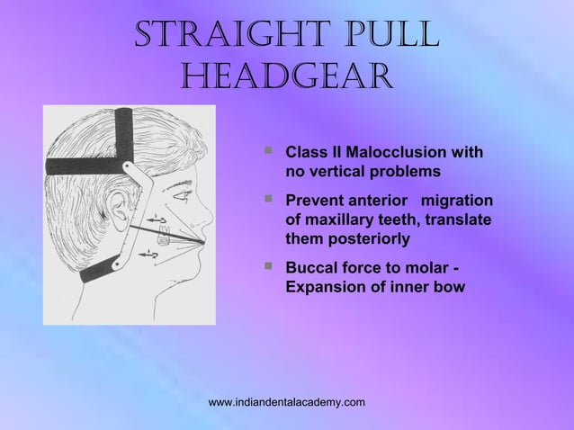 Adjuncts in straight wire technique /certified fixed orthodontic courses by Indian dental ...