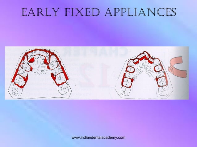 Adjuncts in straight wire technique /certified fixed orthodontic courses by Indian dental ...