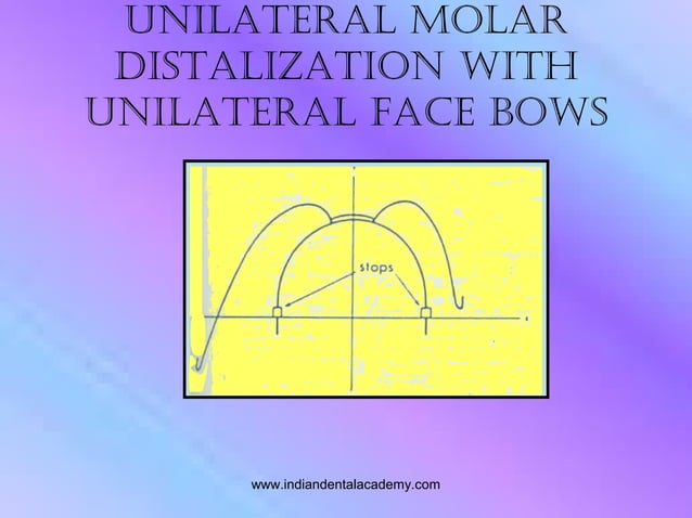 Adjuncts in straight wire technique /certified fixed orthodontic courses by Indian dental ...