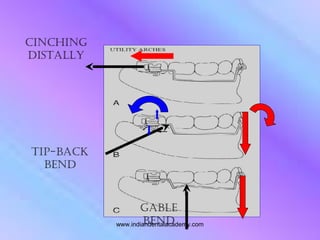 Adjuncts in straight wire technique /certified fixed orthodontic courses by Indian dental ...