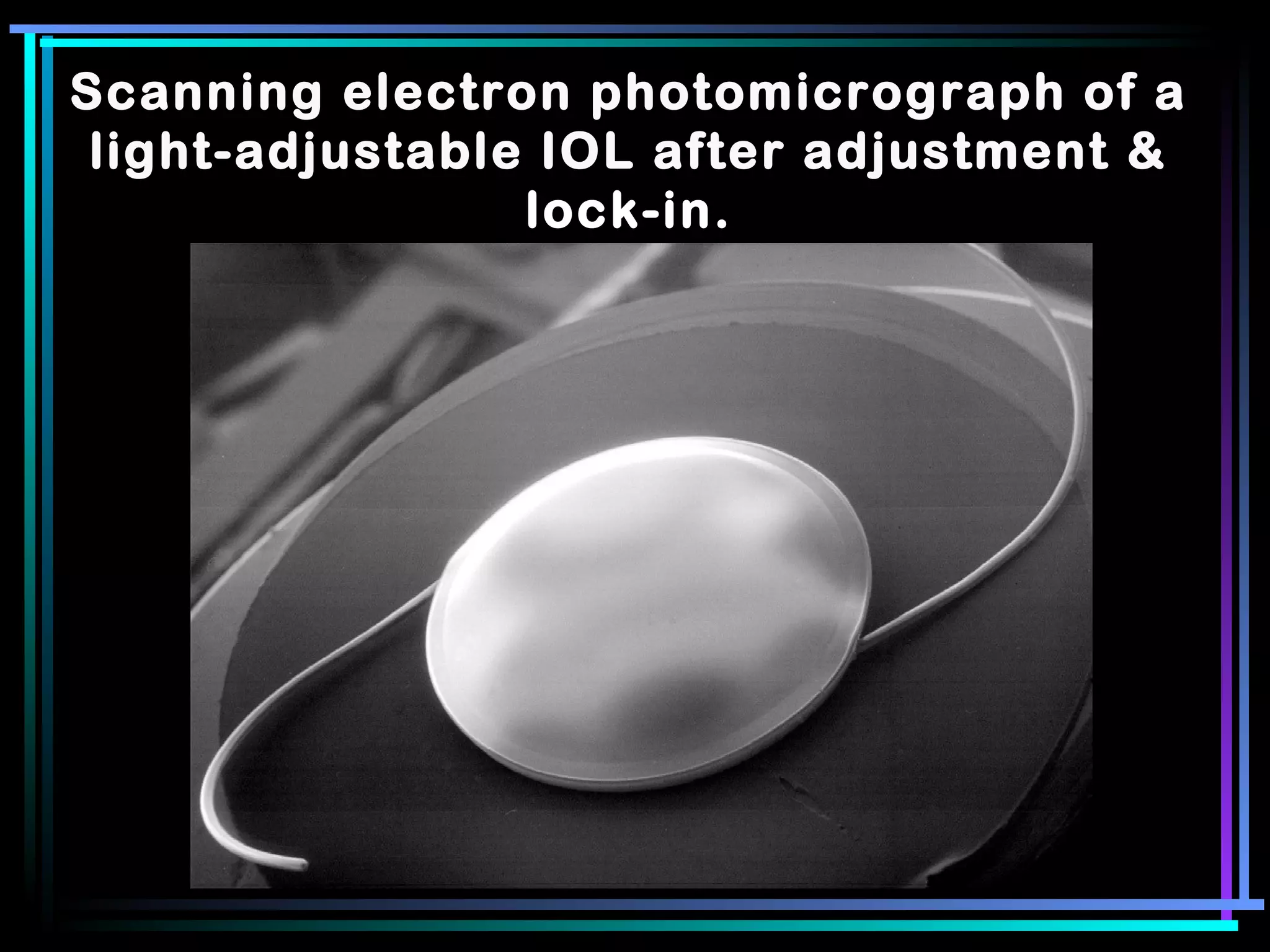 Adjustable intraocular lens power | PPT