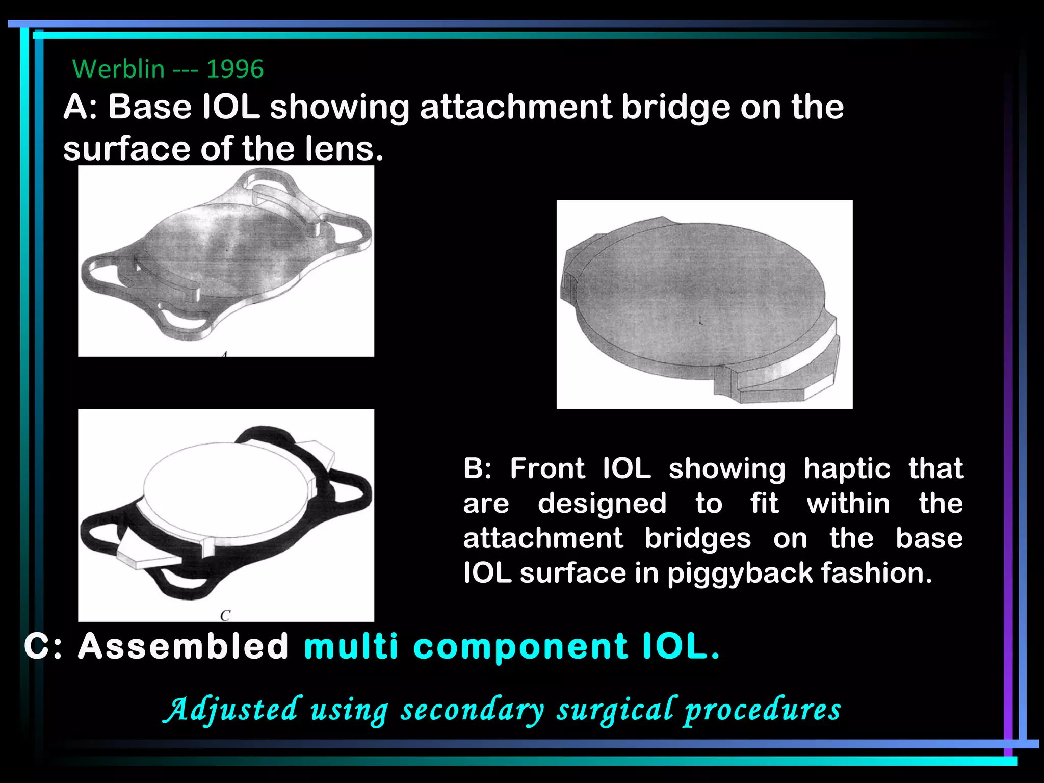 Adjustable intraocular lens power | PPT