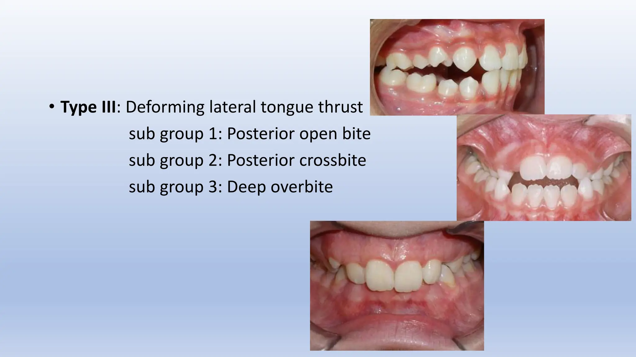 ADJUSTABLE TONGUE CRIB.pptx