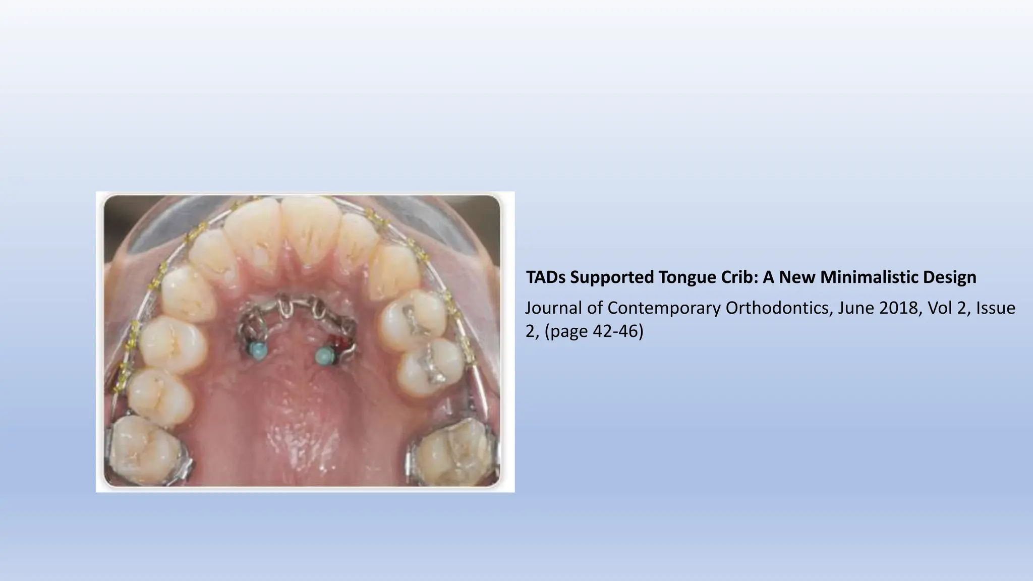 ADJUSTABLE TONGUE CRIB.pptx