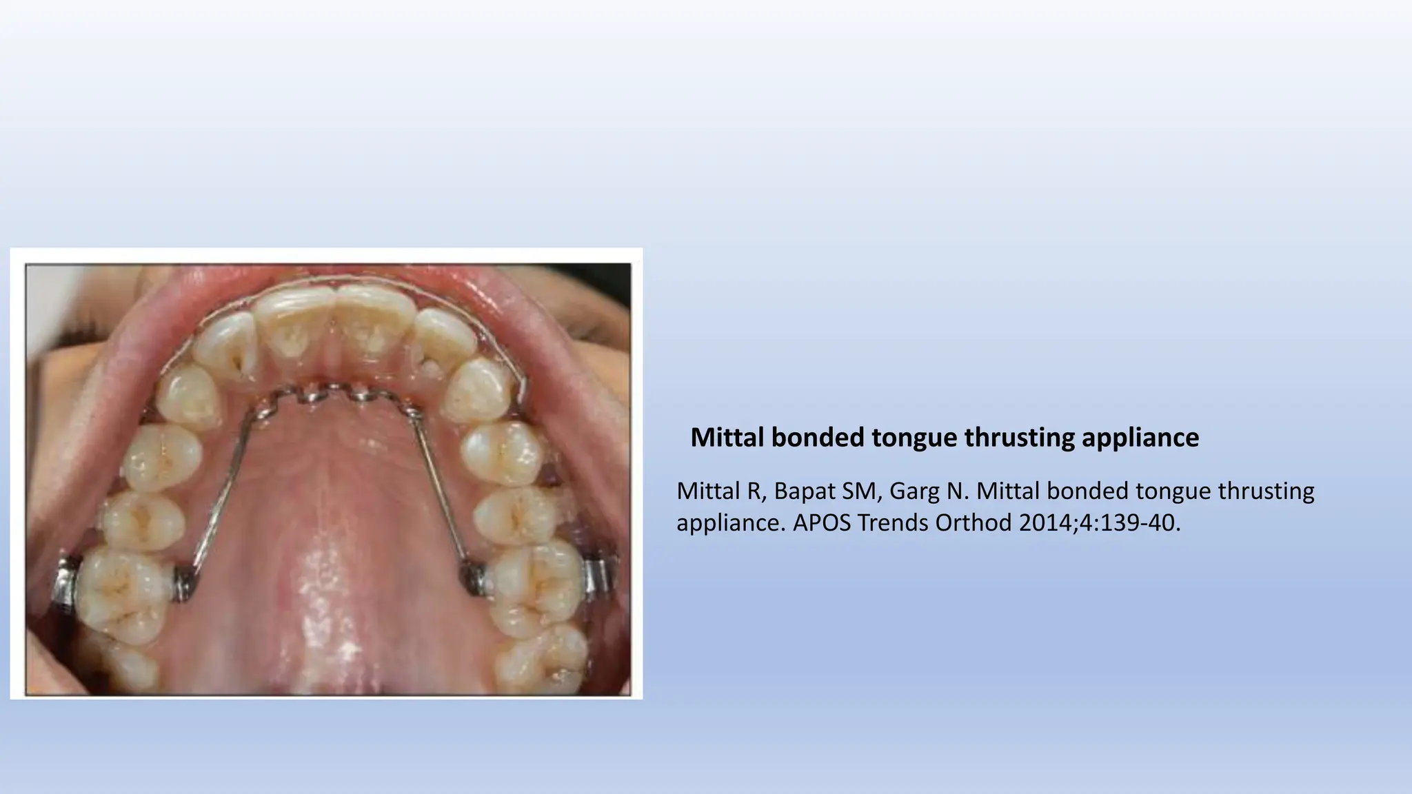 ADJUSTABLE TONGUE CRIB.pptx