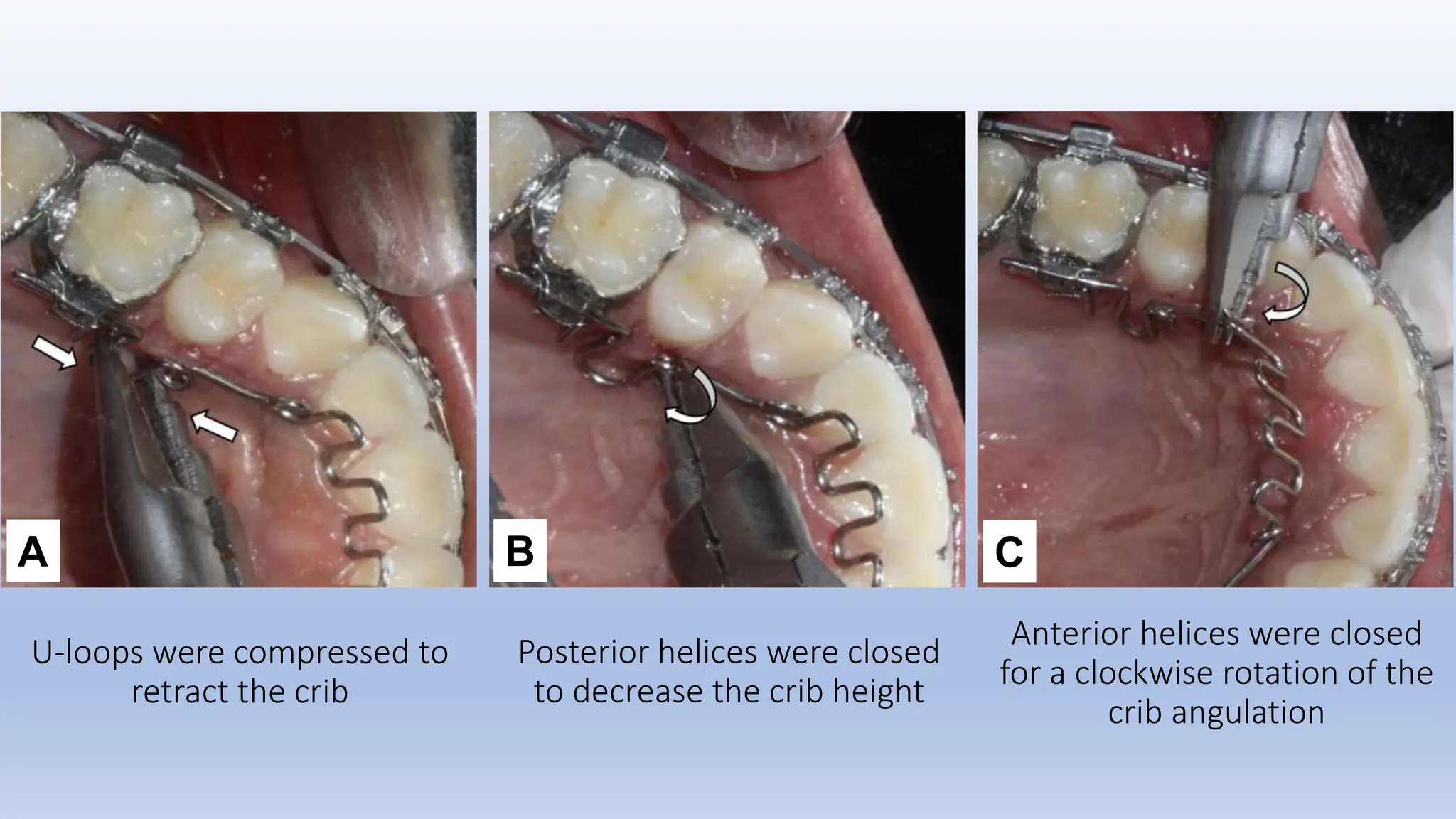 ADJUSTABLE TONGUE CRIB.pptx