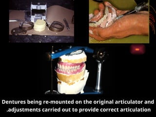 Adjustment of complete denture occlusion.ppt