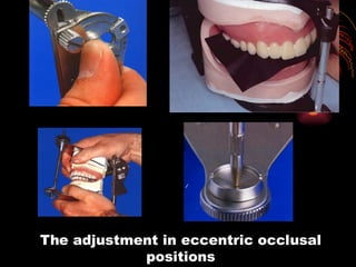 Adjustment of complete denture occlusion.ppt
