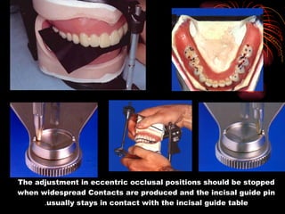 Adjustment of complete denture occlusion.ppt