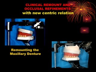 Adjustment of complete denture occlusion.ppt