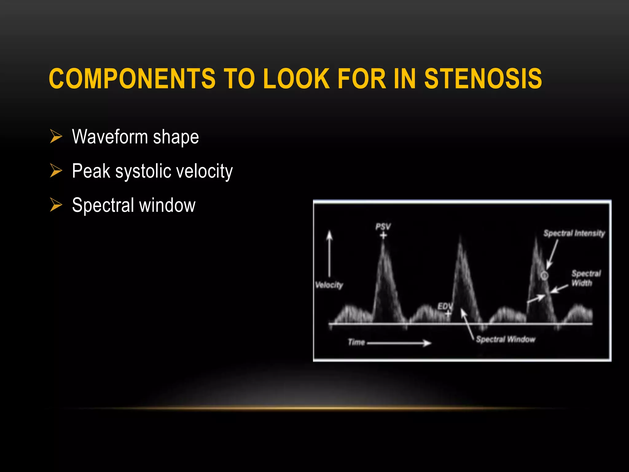 Arterial doppler lower limbs.pptx