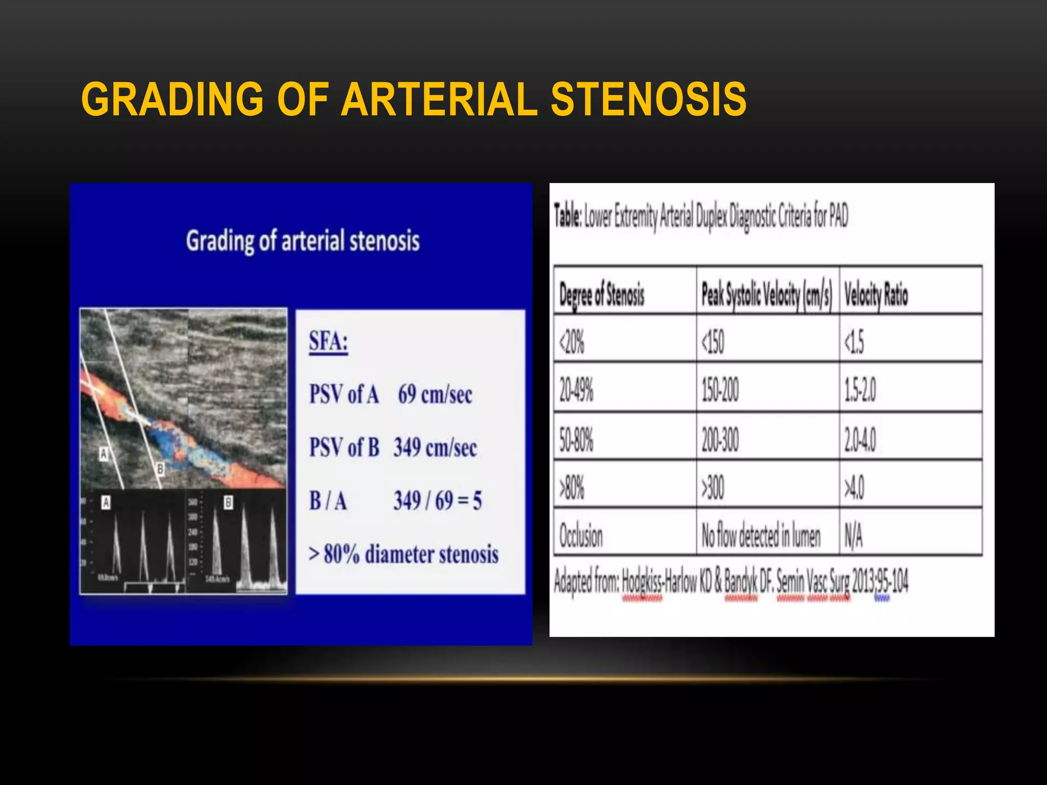 Arterial doppler lower limbs.pptx