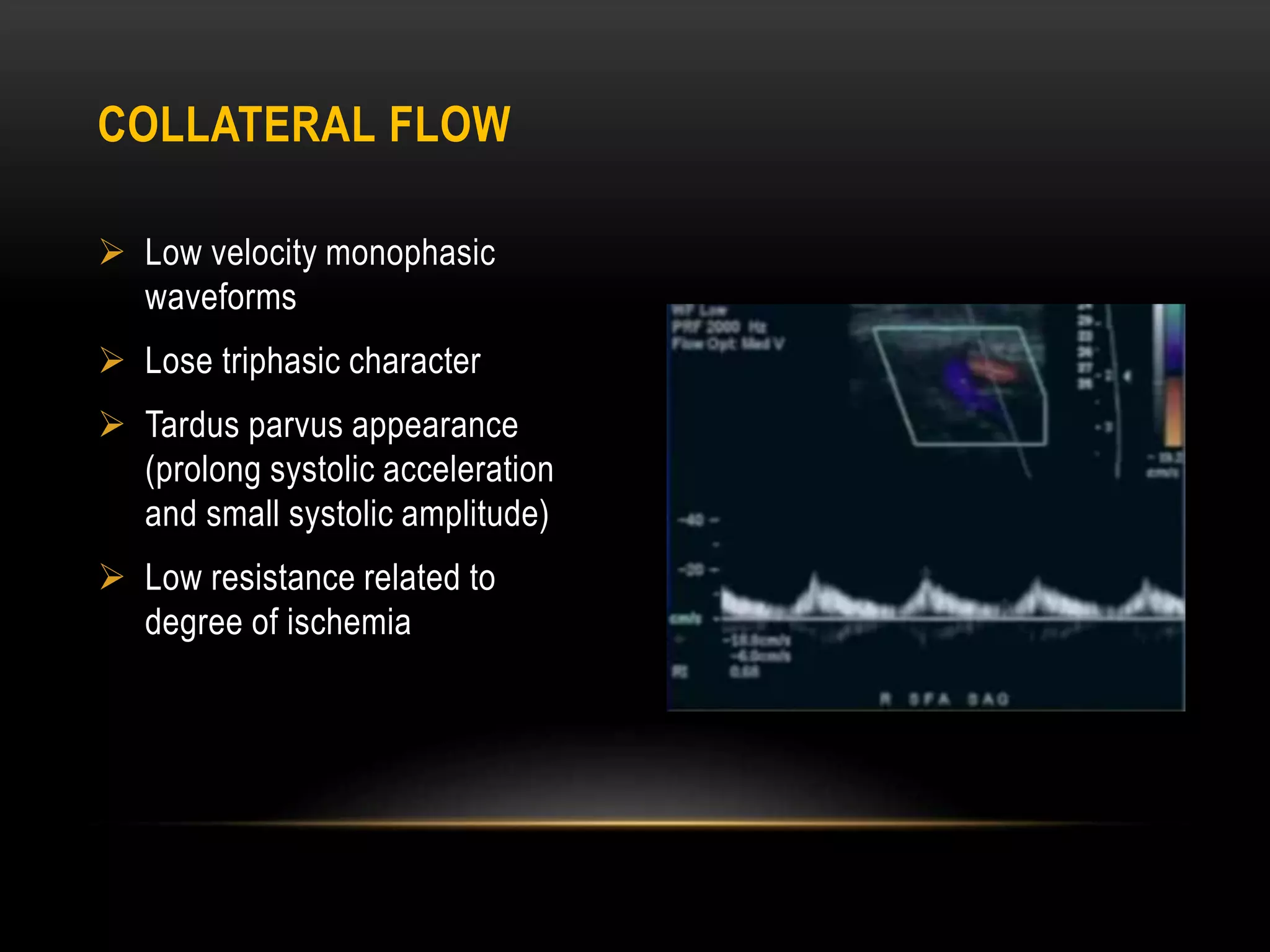 Arterial doppler lower limbs.pptx