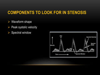 Arterial doppler lower limbs.pptx