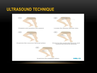 Arterial doppler lower limbs.pptx