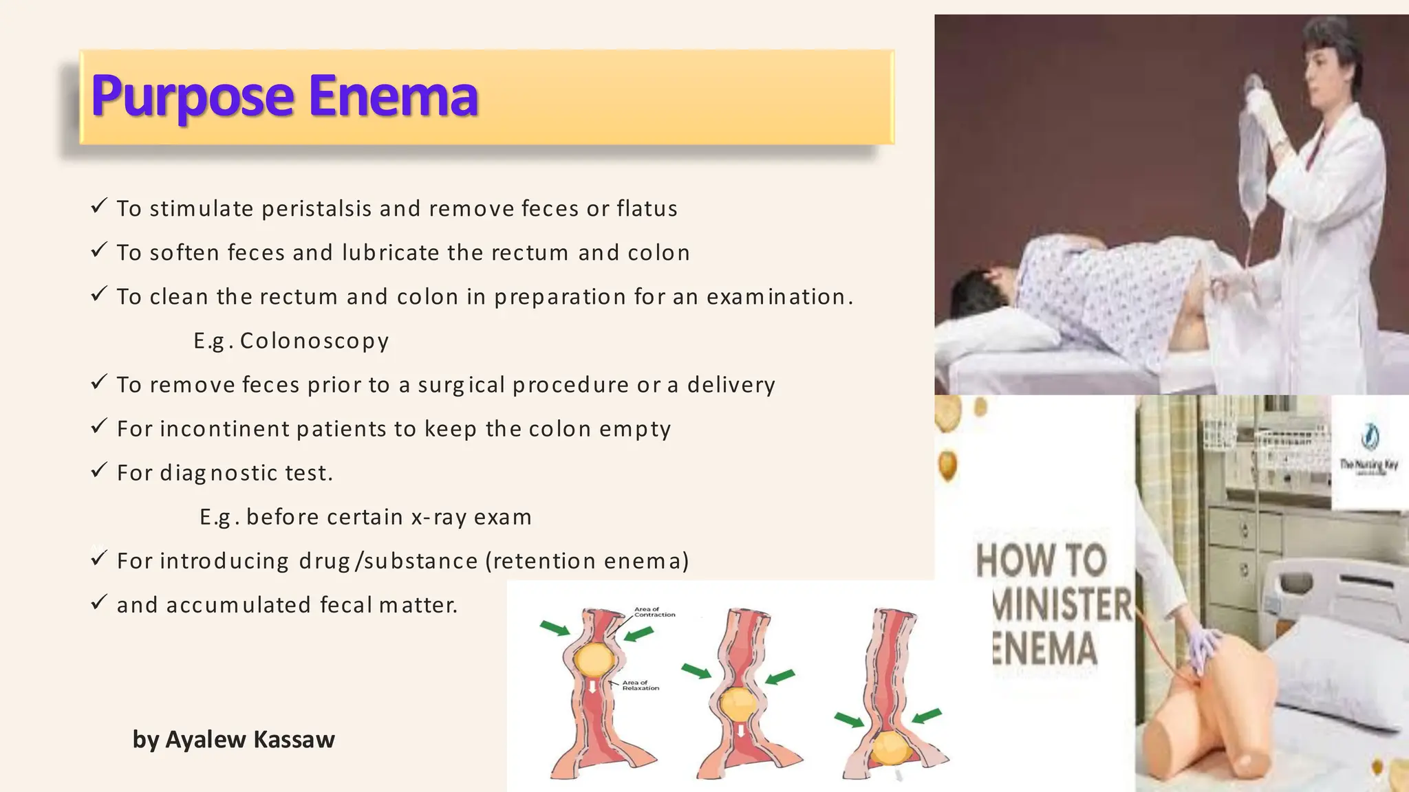Administering-Enema.pdf for nursing students 2024 | PDF