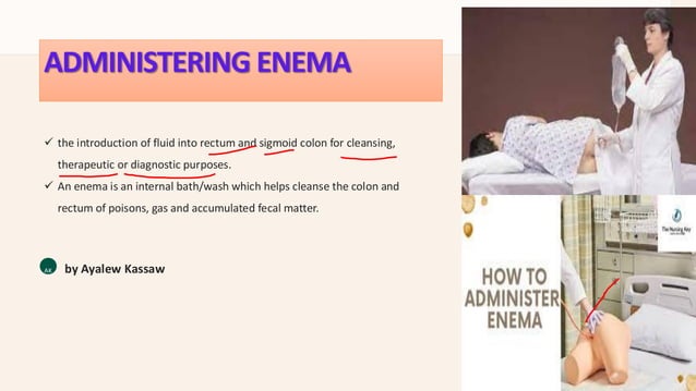 Administering-Enema.pdf for nursing students 2024 | PDF