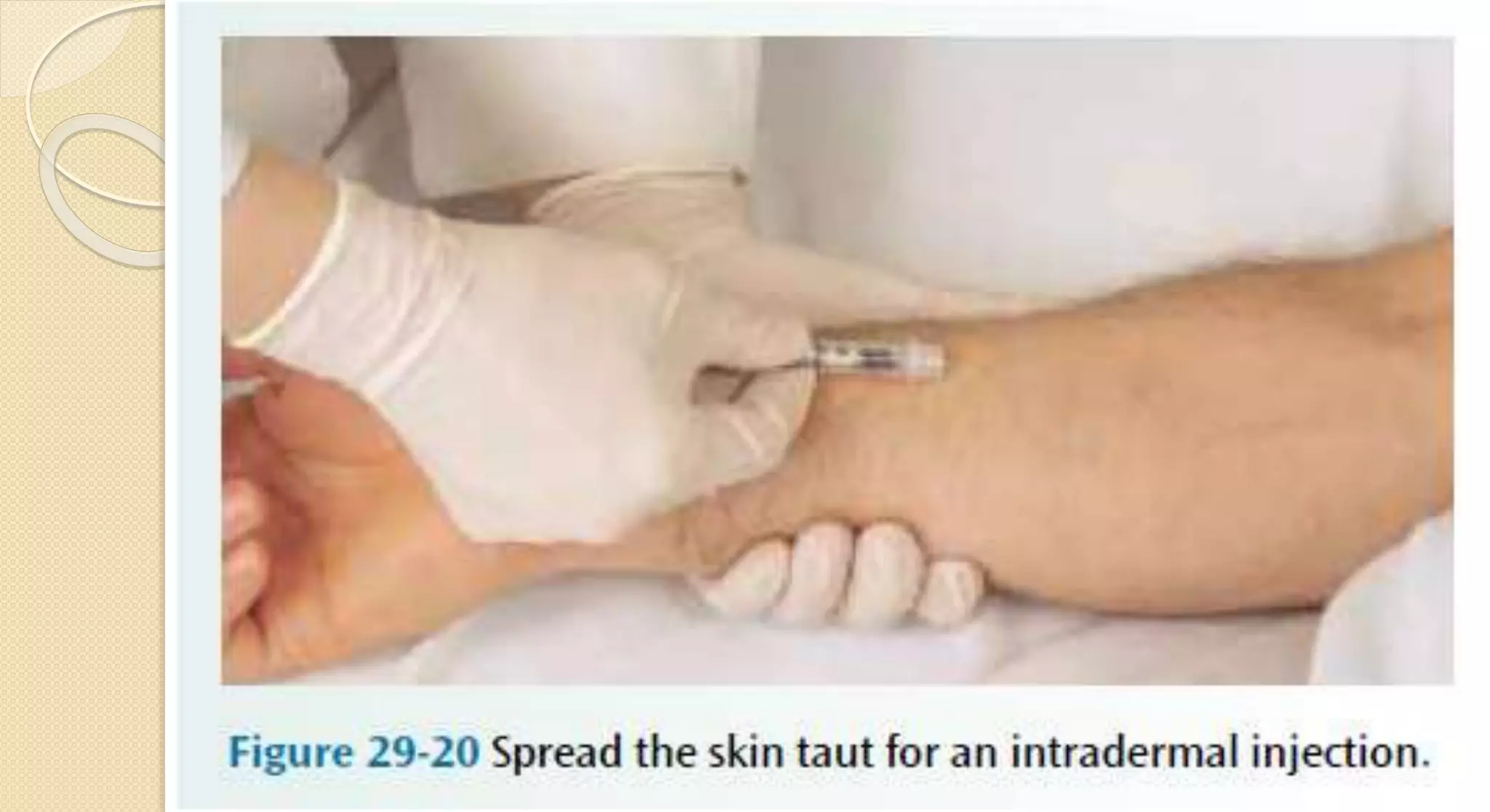 Administering an intradermal injection.pptx