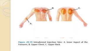 Administering an intradermal injection.pptx