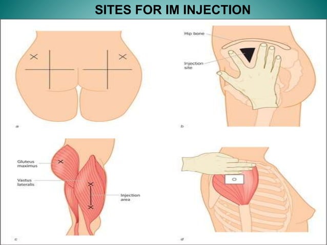ADMINISTERING INTERAMUSCULAR INJECTIONS.pptx