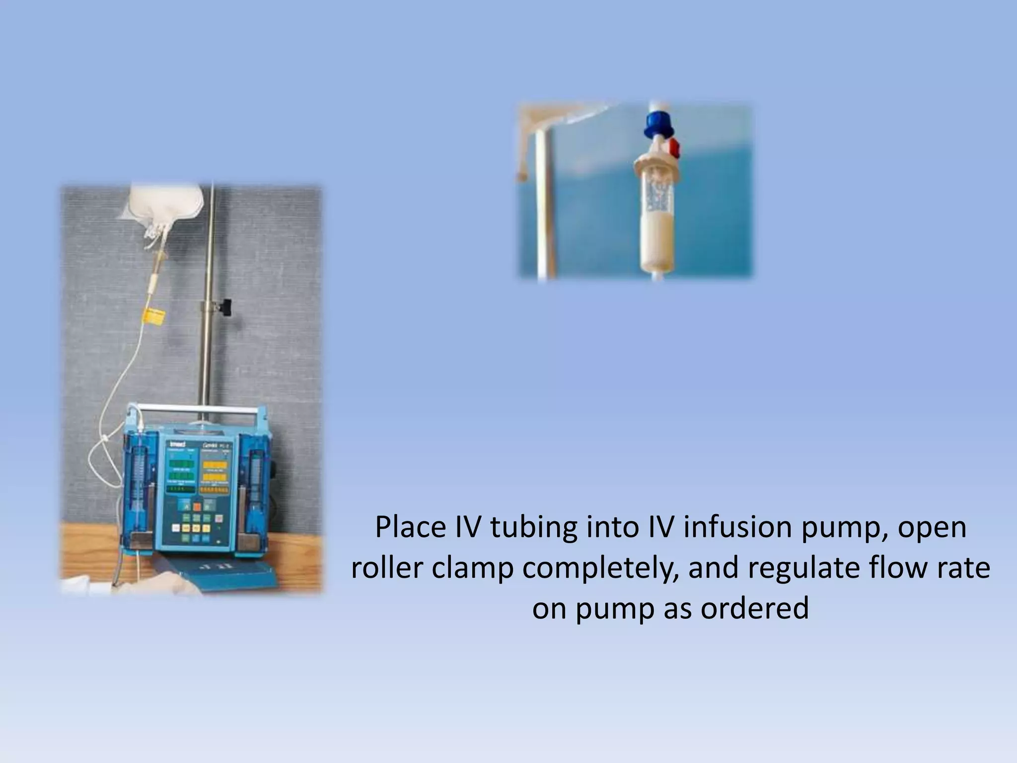 Administering TPN | PPTX