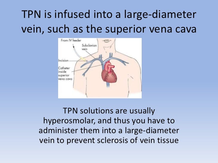 Administering TPN