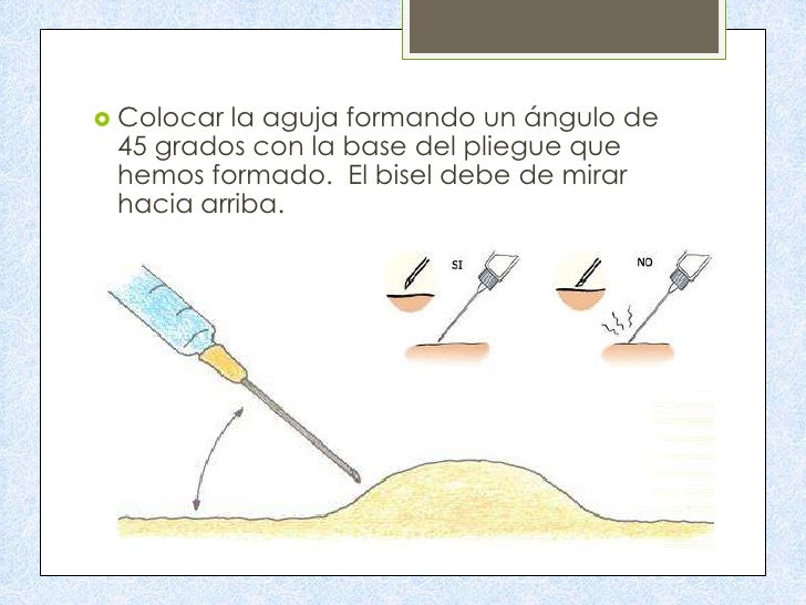 Administración parenteral de medicamentos