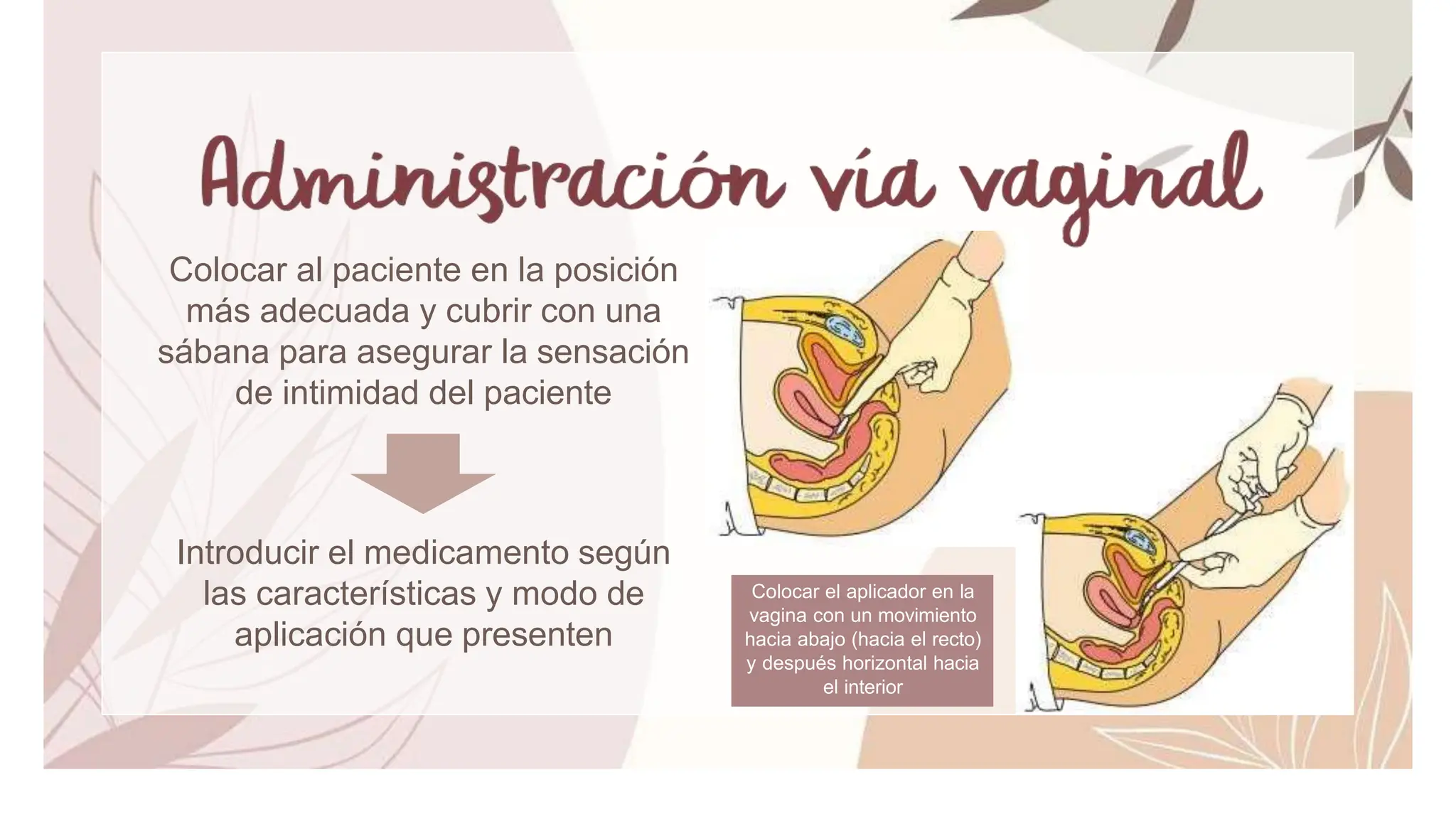 Administracion De Medicamentos Via Vaginal 1 13 Pptx Women S Health