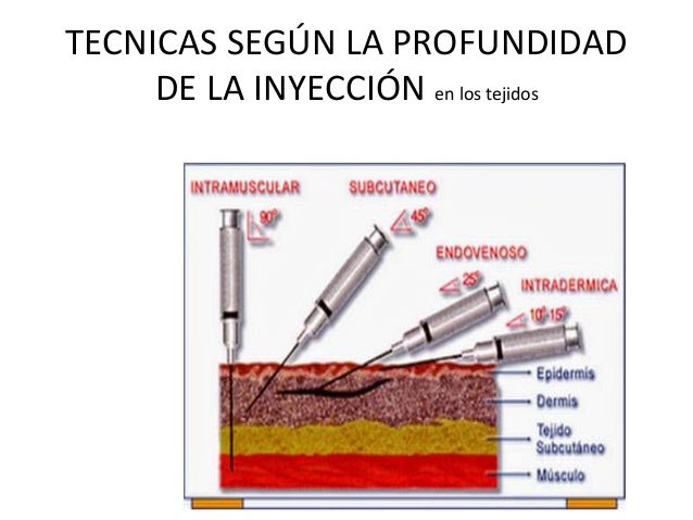 Administracion vía intramuscular de medicamentos