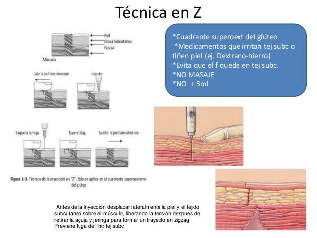 Administracion vía intramuscular de medicamentos