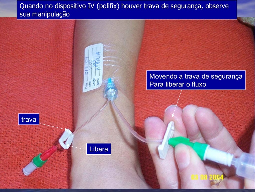 Administração de medicamentos iv