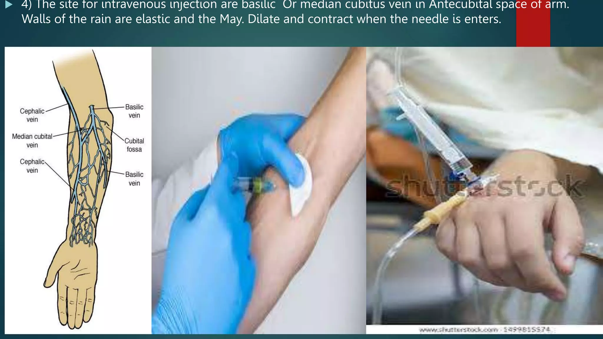 ADMINISTRATION OF INJECTION by ram.pptx