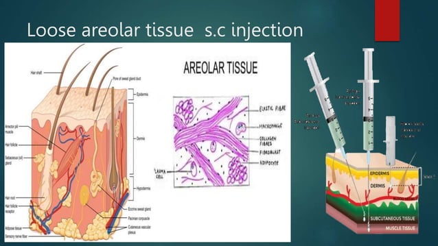ADMINISTRATION OF INJECTION by ram.pptx