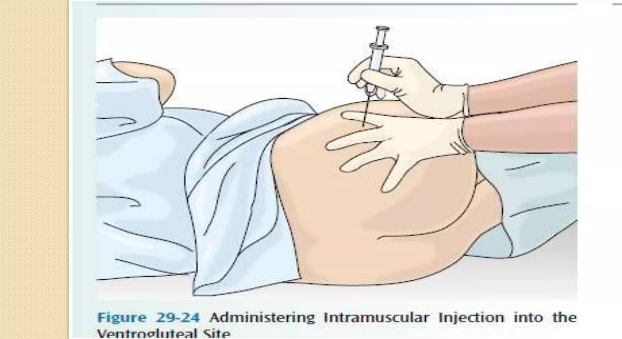 Administration of intramuscular injection.pptx