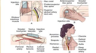 Administration of intramuscular injection.pptx | First Aid | Injuries