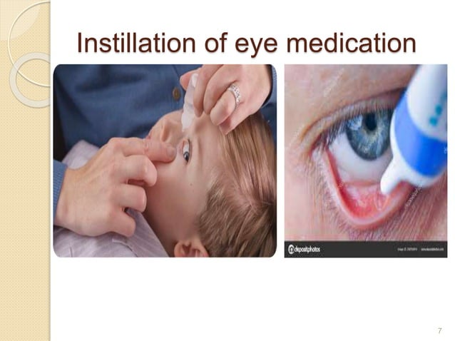 Administration of Medications into Eye and Ear- Topical Application | PPTX