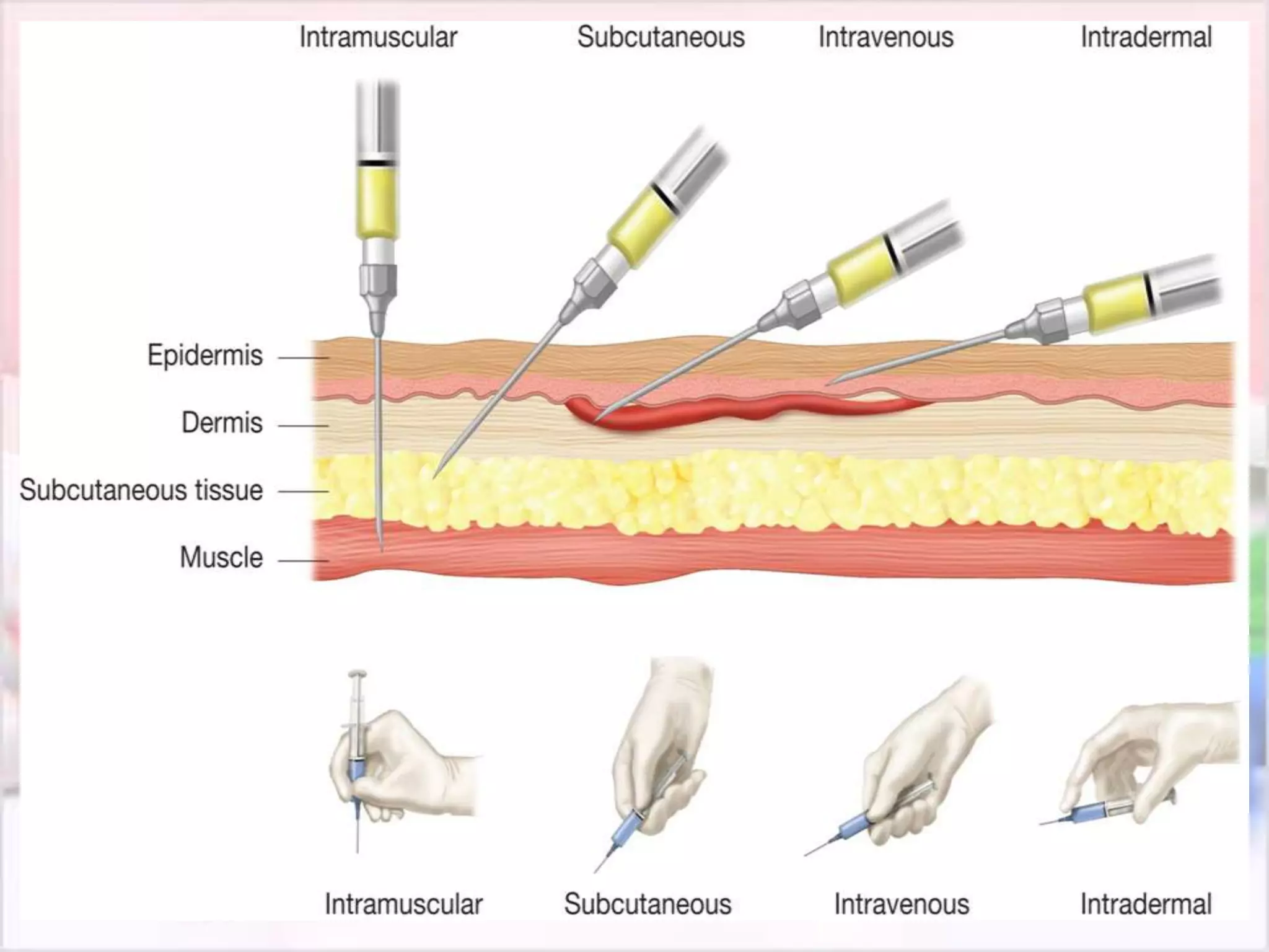 Administration of medications | PPTX
