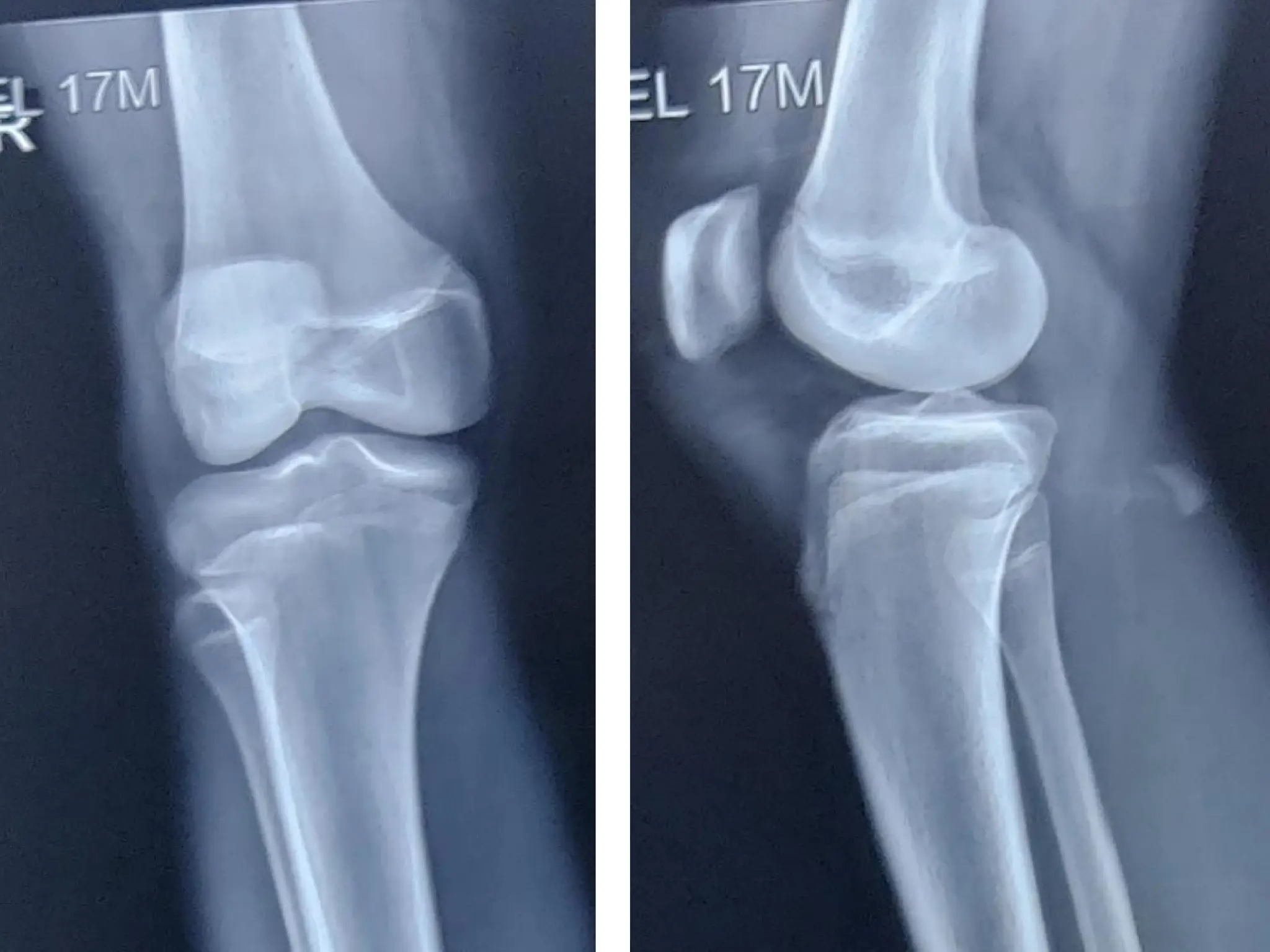 ADMISSION DAY PPT ON ward case presentation | PPT