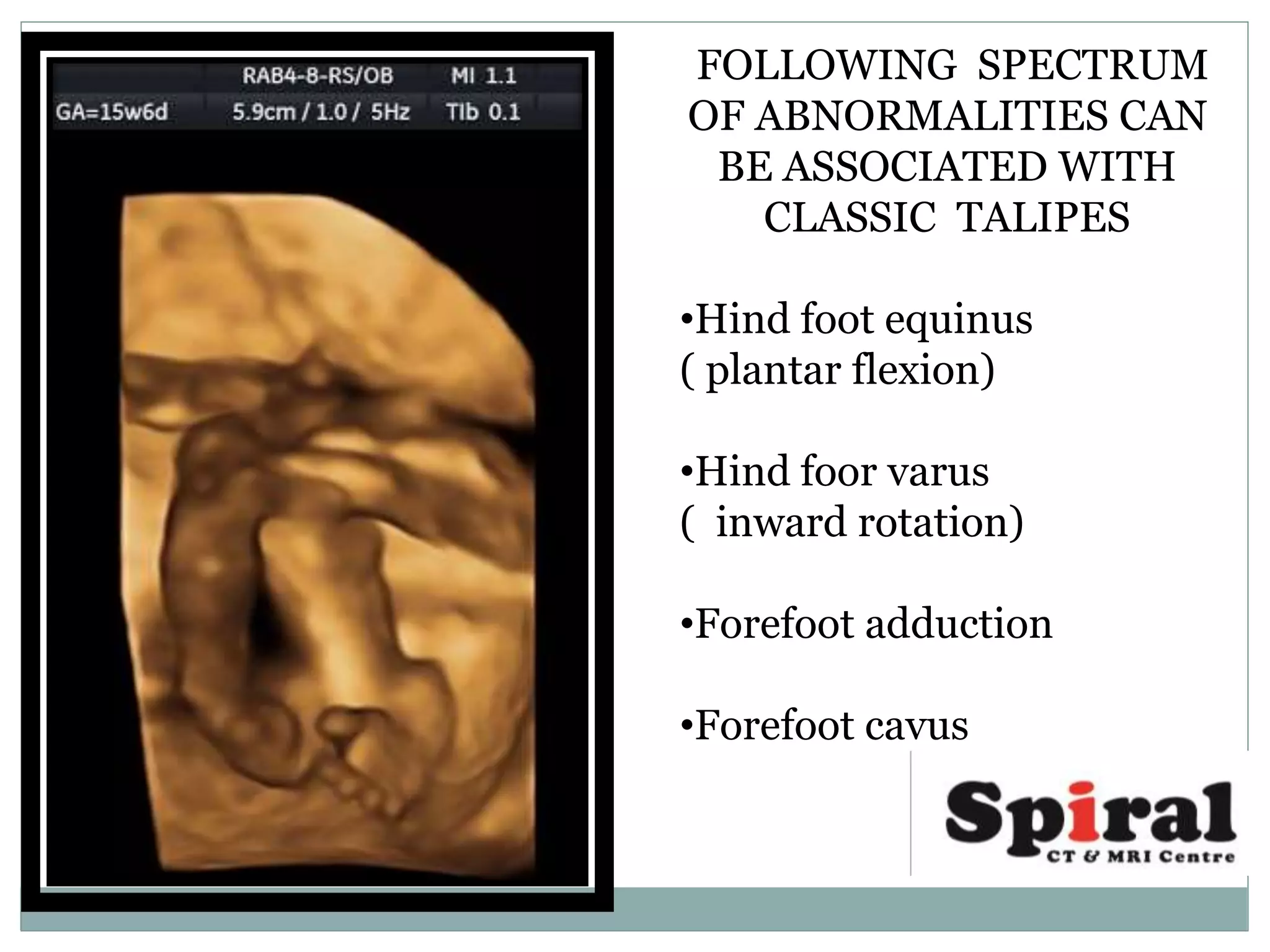 ADVANCED USG LOUNGE FETAL FEET | PPT