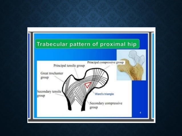 Neck of femur fracture its classification and treatment | PPT